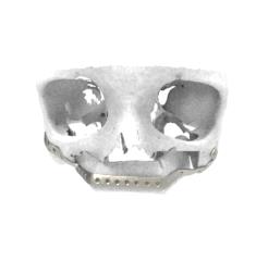 LaserImplant Maxilla implant